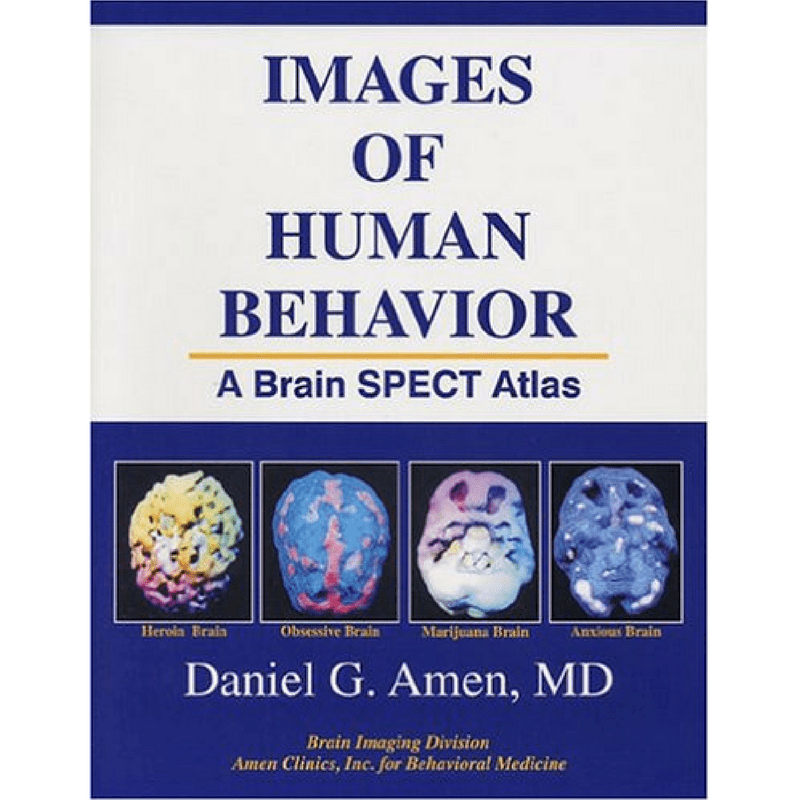 Images of Human Behavior: A Brain SPECT Atlas